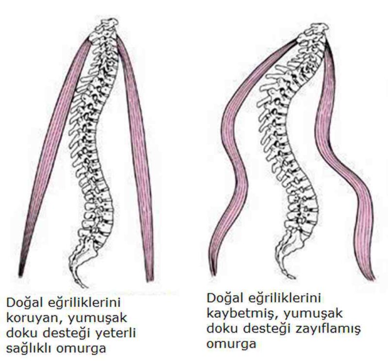 Omurga Yetmezliği - Prof. Dr. Turan Uslu - 2025
